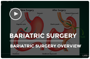 Bariatric Surgey Program Overview