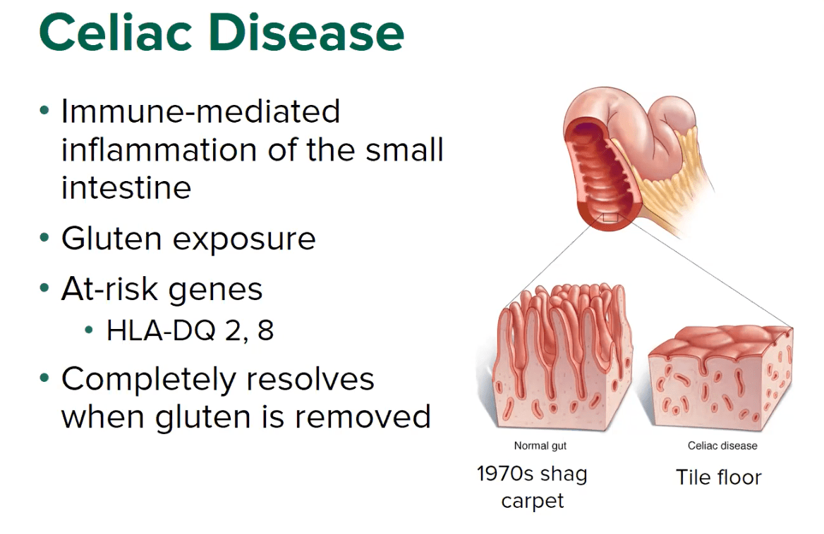 Celiac Disease - UAB Medicine