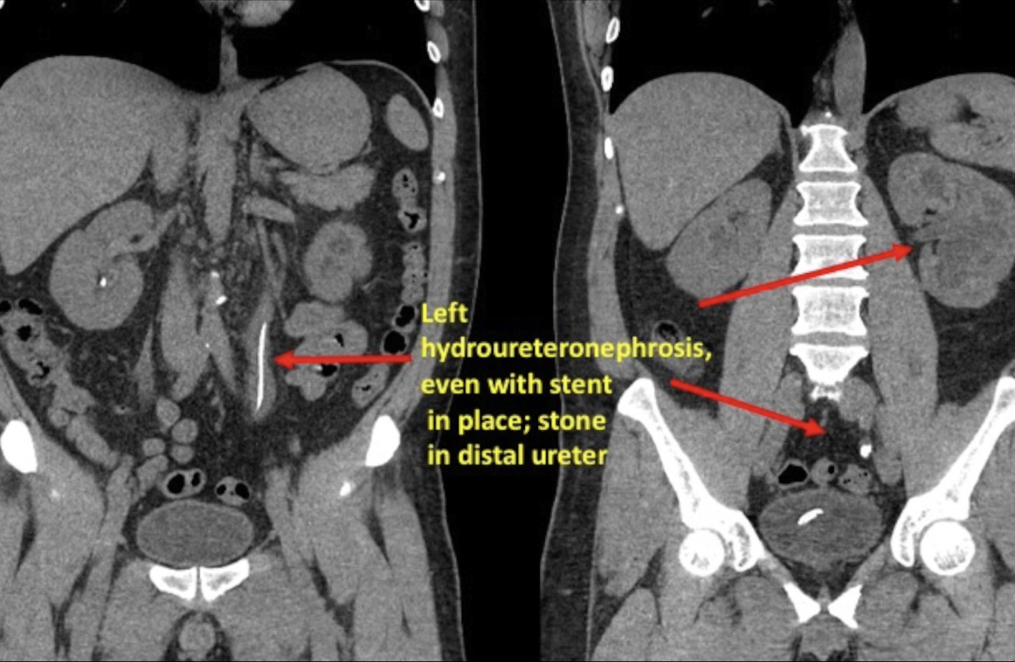 Urology