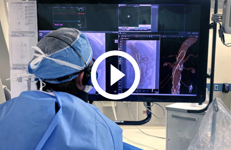 LumiGuide for Aneurysm Repair - UAB Medicine